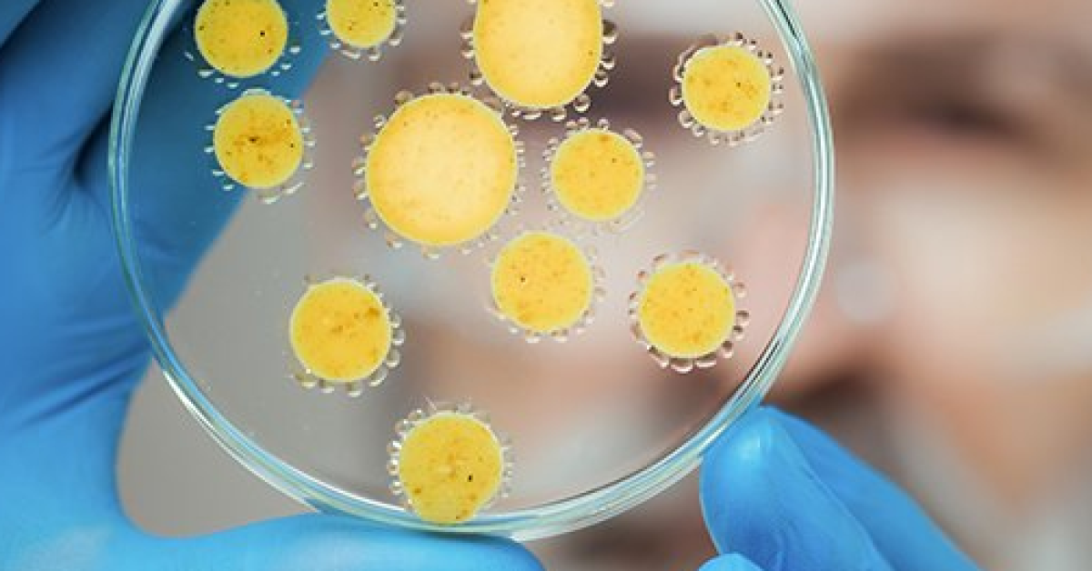 ENFERMAGEM EM INFECTOLOGIA - Faculdade Super